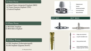 Basal implant - a newer variety of implant system | PPTX