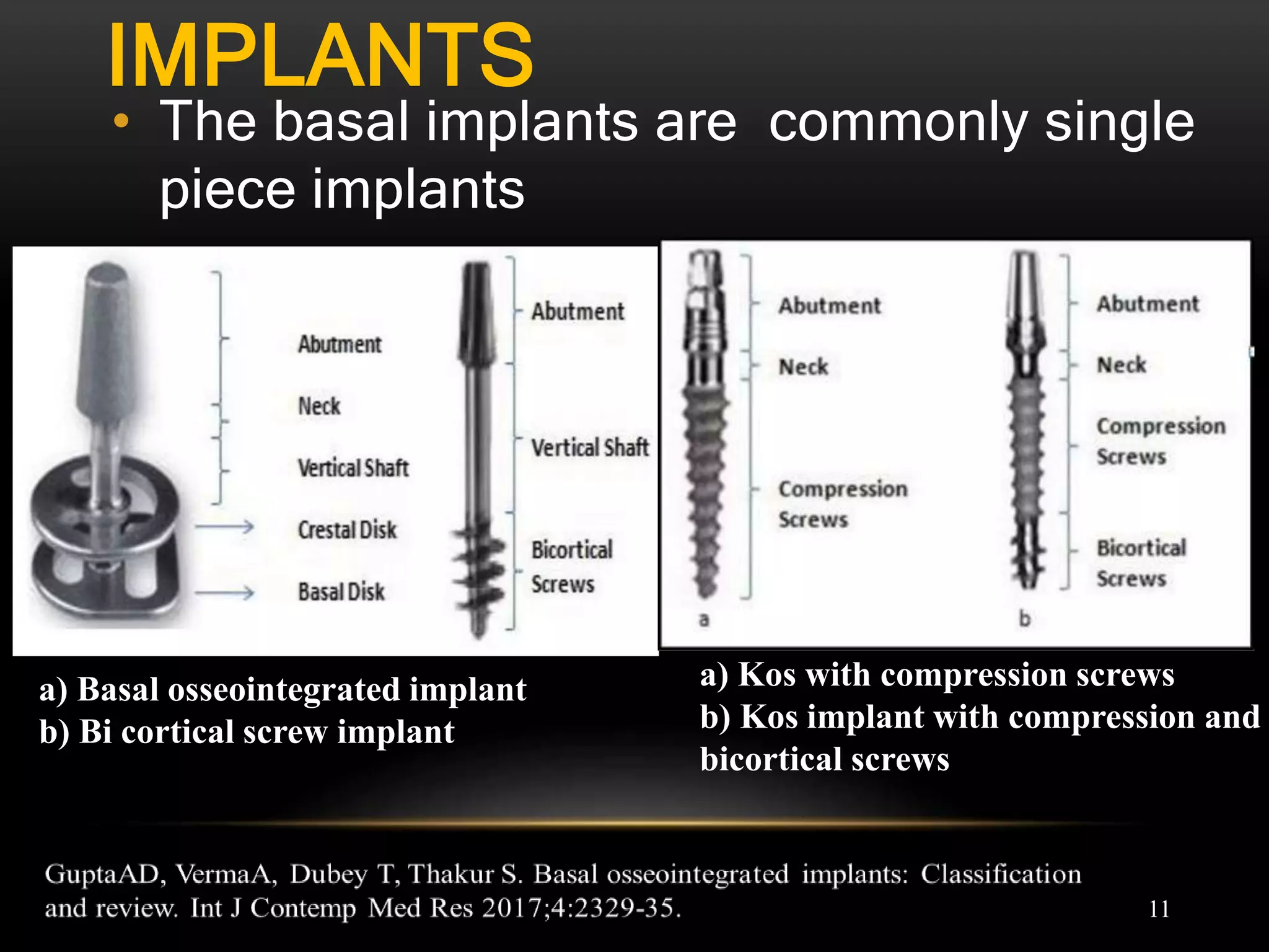 BASAL IMPLANTOLOGY gupta.pptx
