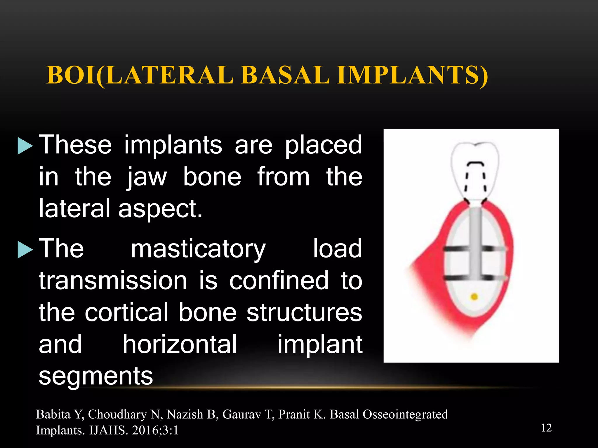 BASAL IMPLANTOLOGY gupta.pptx