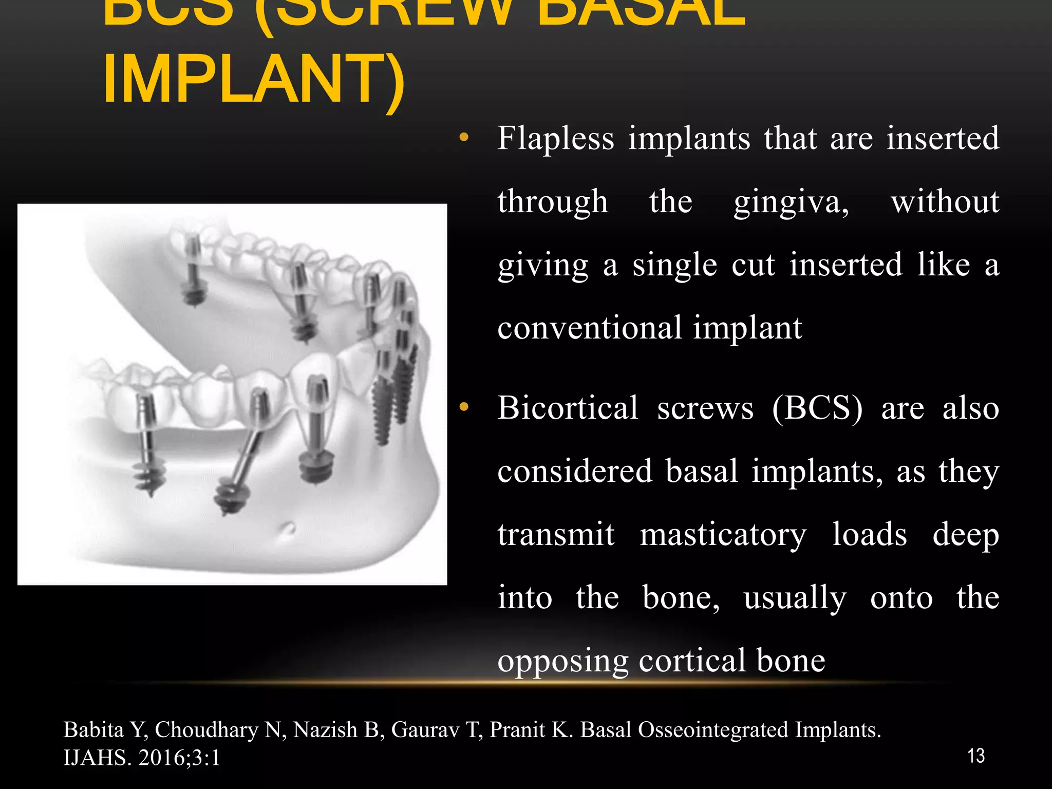 BASAL IMPLANTOLOGY gupta.pptx
