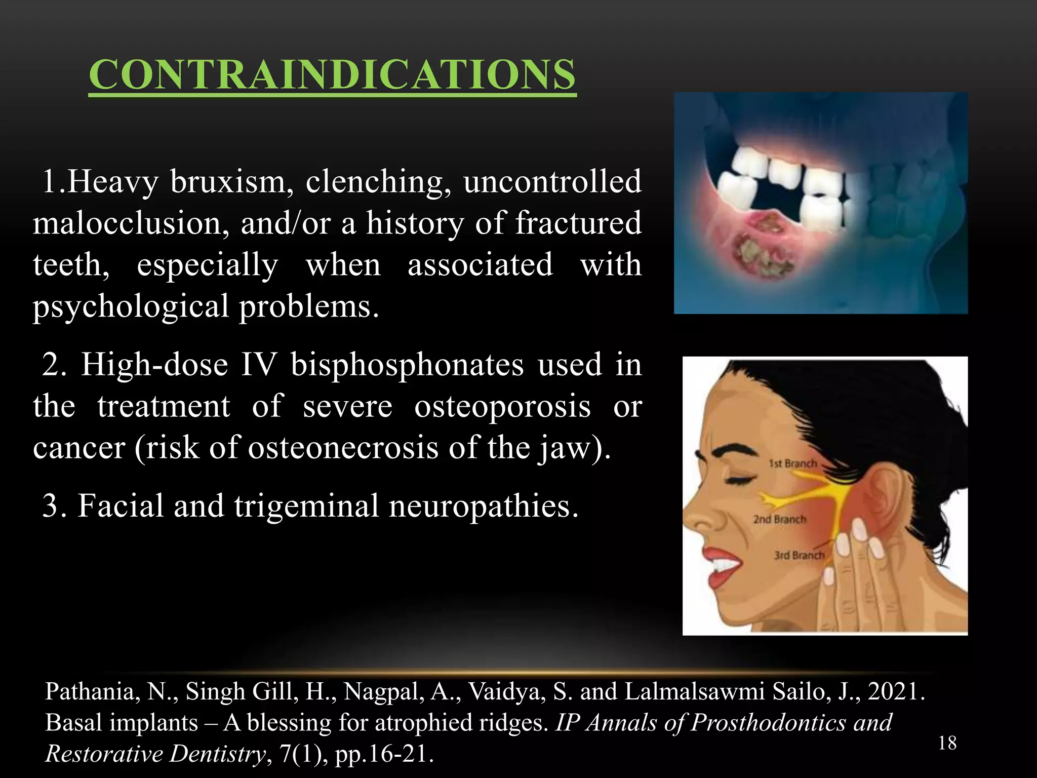 BASAL IMPLANTOLOGY gupta.pptx
