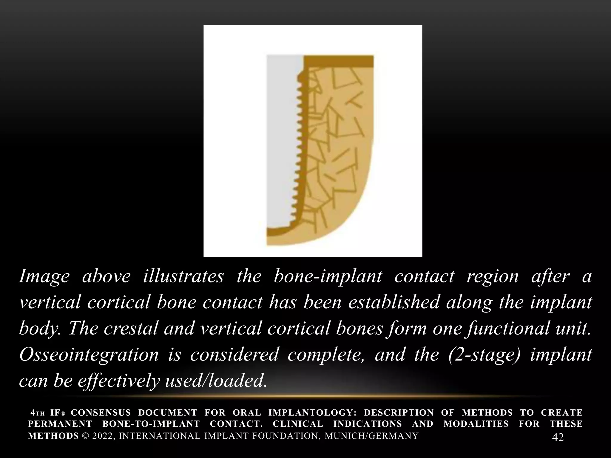BASAL IMPLANTOLOGY gupta.pptx