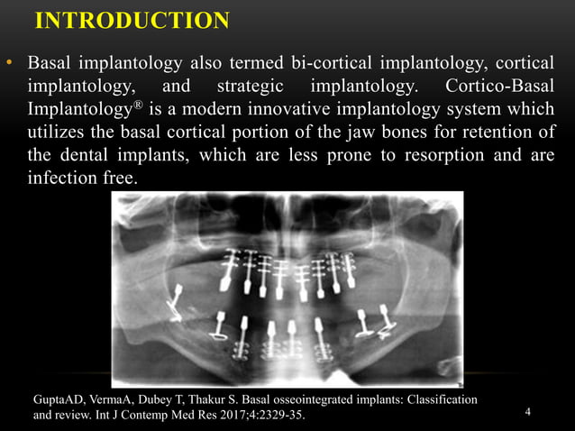 BASAL IMPLANTOLOGY gupta.pptx | Dental Health | Diseases and Conditions