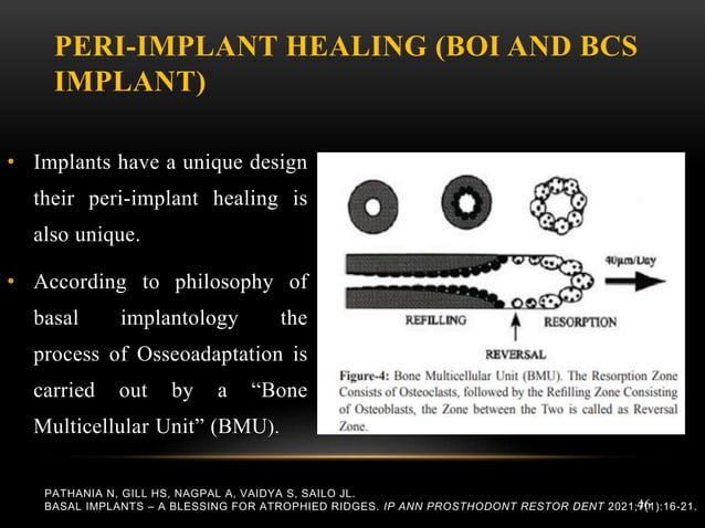BASAL IMPLANTOLOGY gupta.pptx | Dental Health | Diseases and Conditions