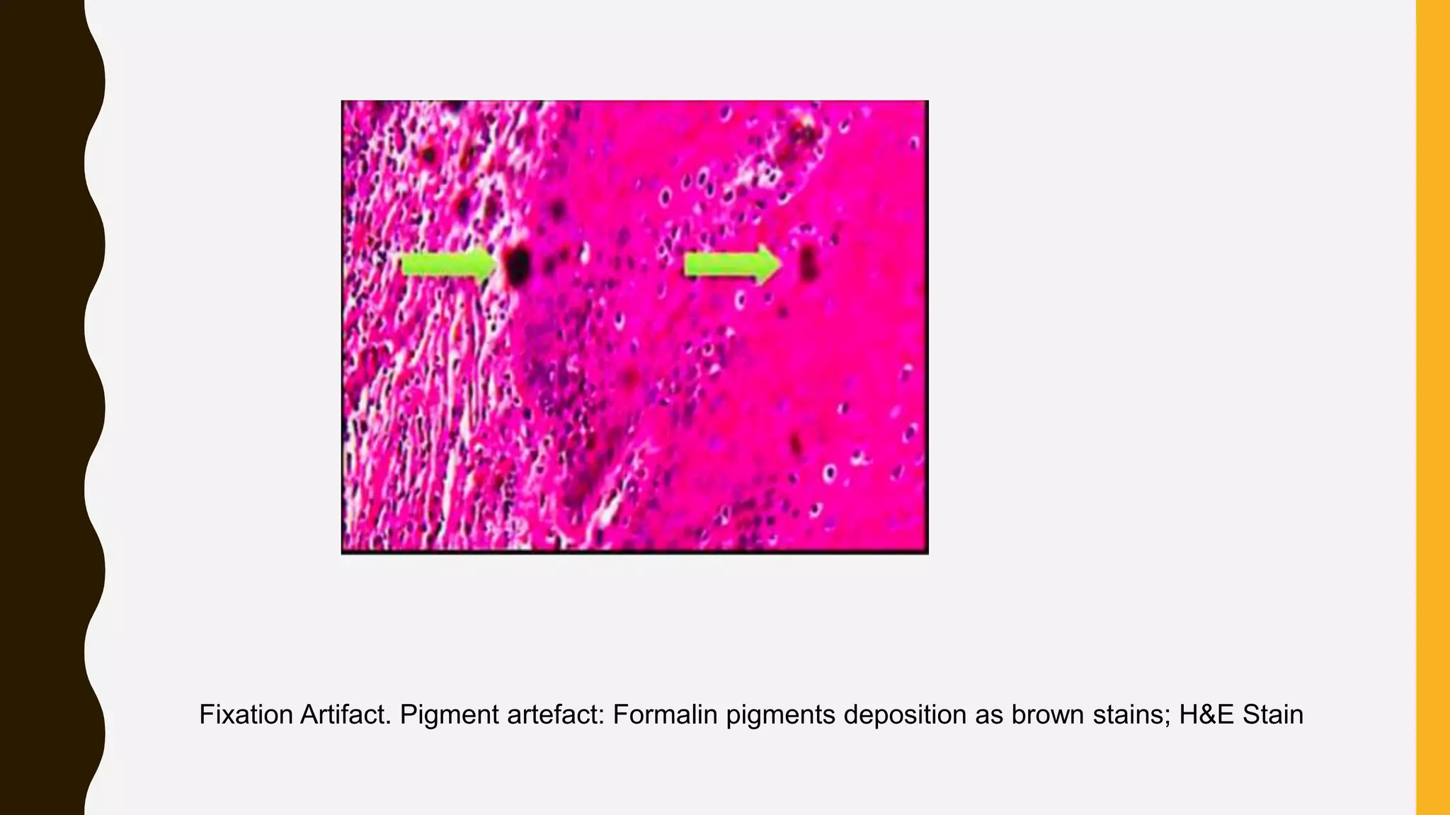 BASAL LAYER DEGENERATION VS ARTIFACT | PPTX