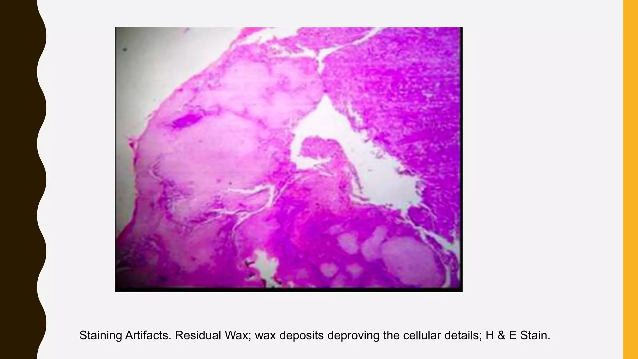 BASAL LAYER DEGENERATION VS ARTIFACT | PPTX