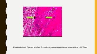 BASAL LAYER DEGENERATION VS ARTIFACT | PPTX