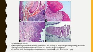 BASAL LAYER DEGENERATION VS ARTIFACT | PPTX