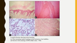 BASAL LAYER DEGENERATION VS ARTIFACT | PPTX