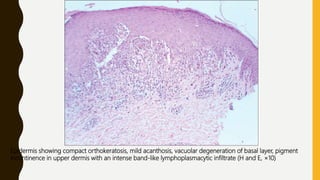 BASAL LAYER DEGENERATION VS ARTIFACT | PPTX
