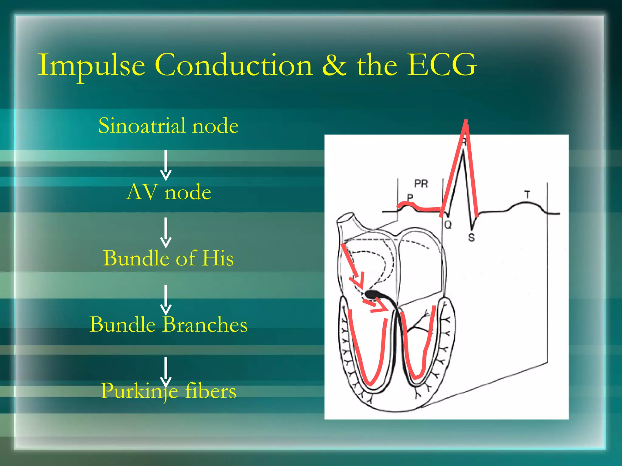 ECG Basics | PPT