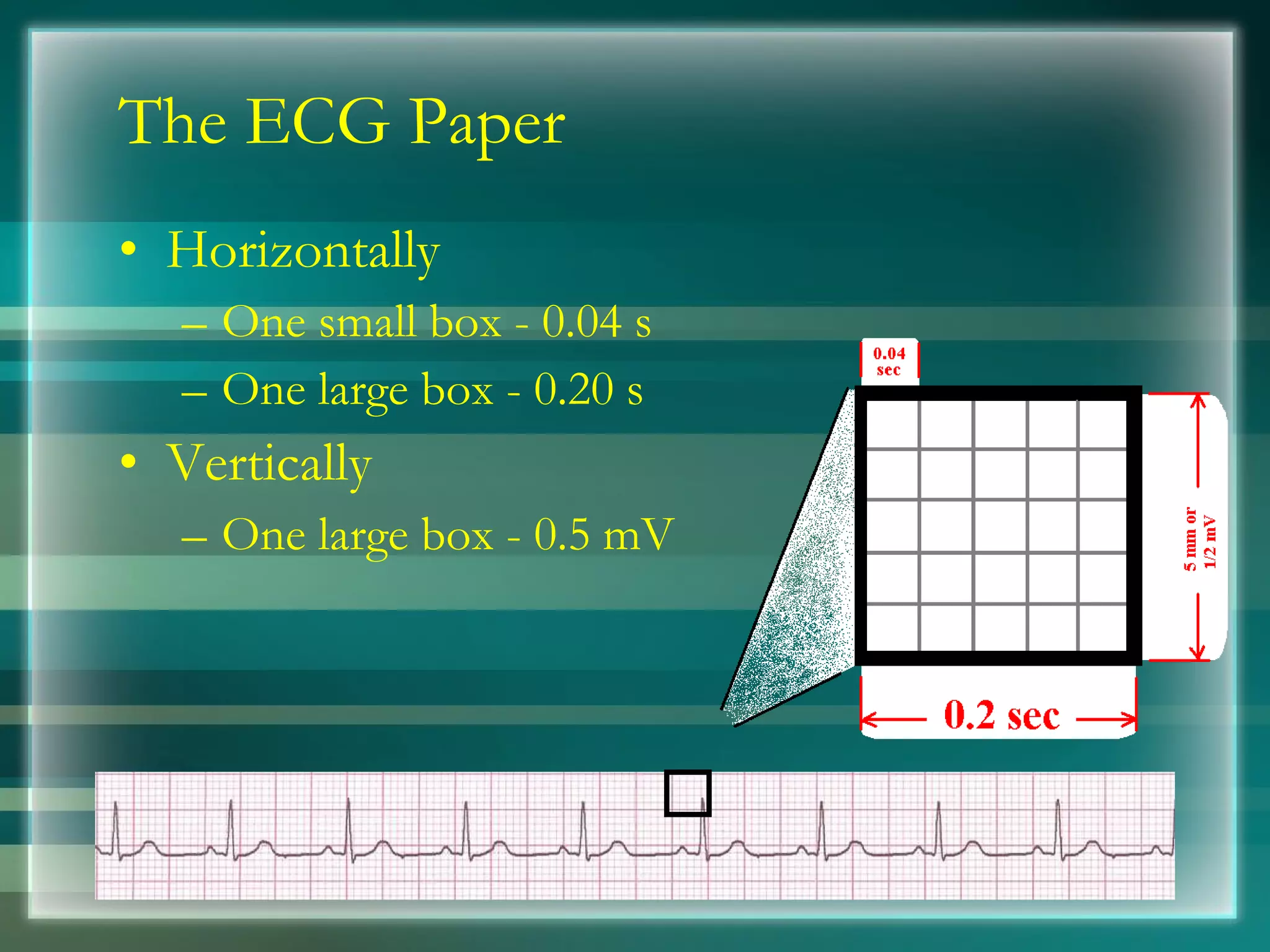 ECG Basics | PPT