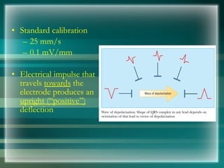 ECG Basics | PPT