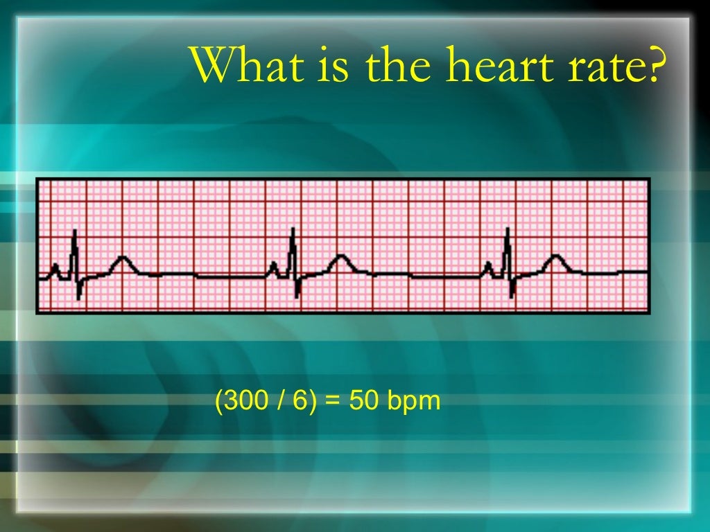 ECG Basics