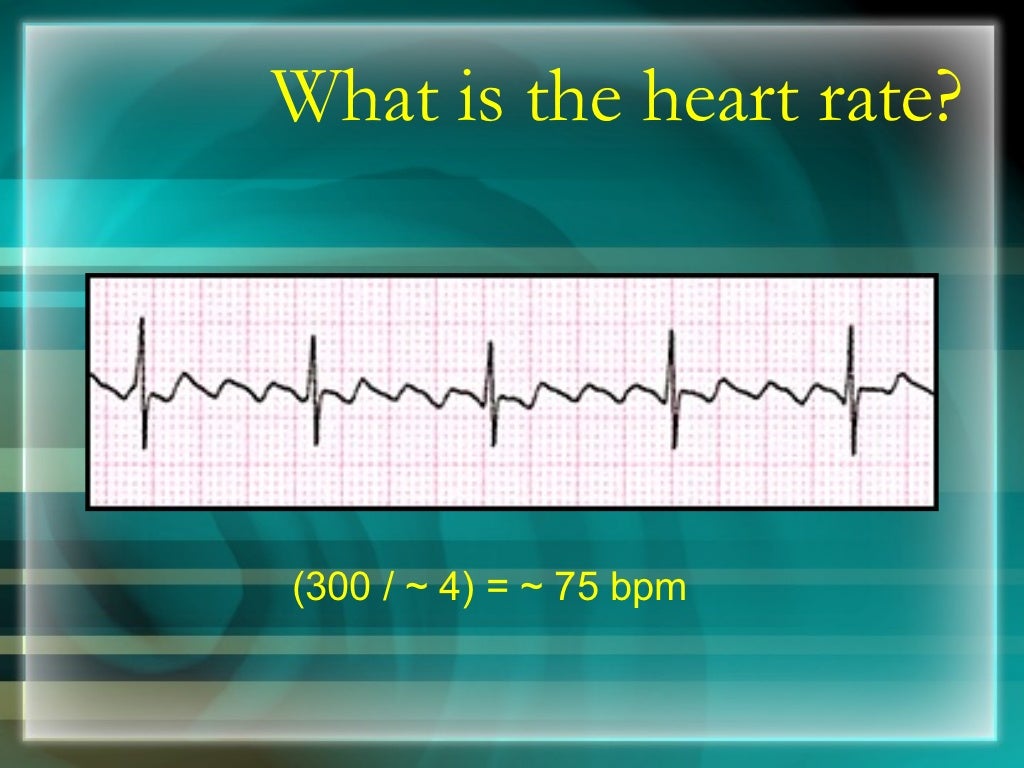 ECG Basics