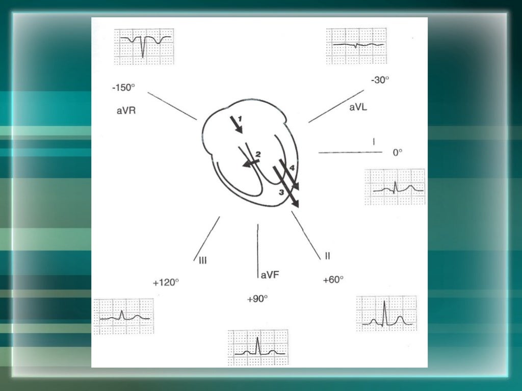 ECG Basics