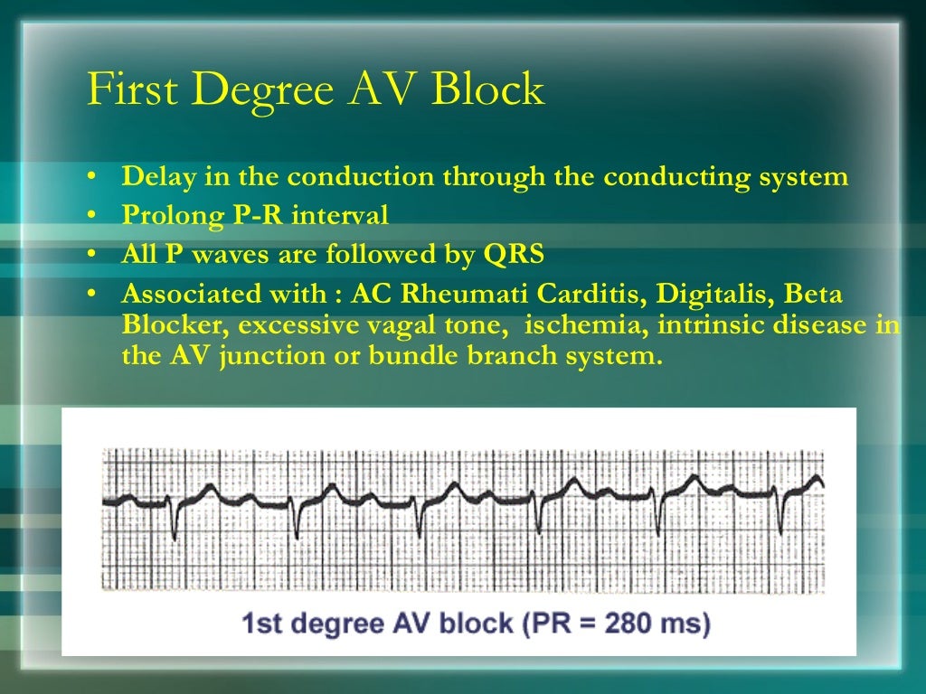 ECG Basics