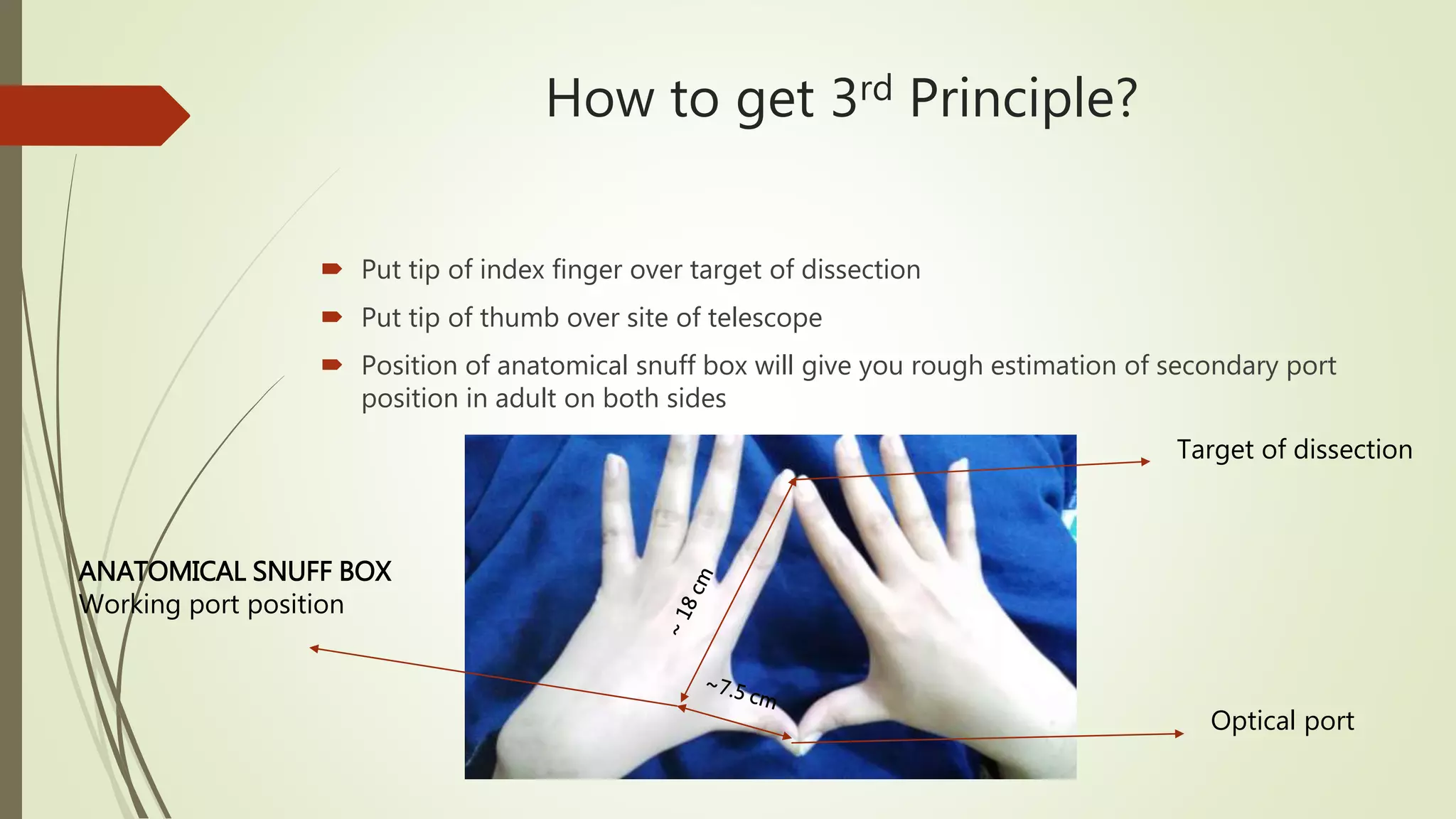 Baseball diamond concept for port position in laparoscopy | PPTX