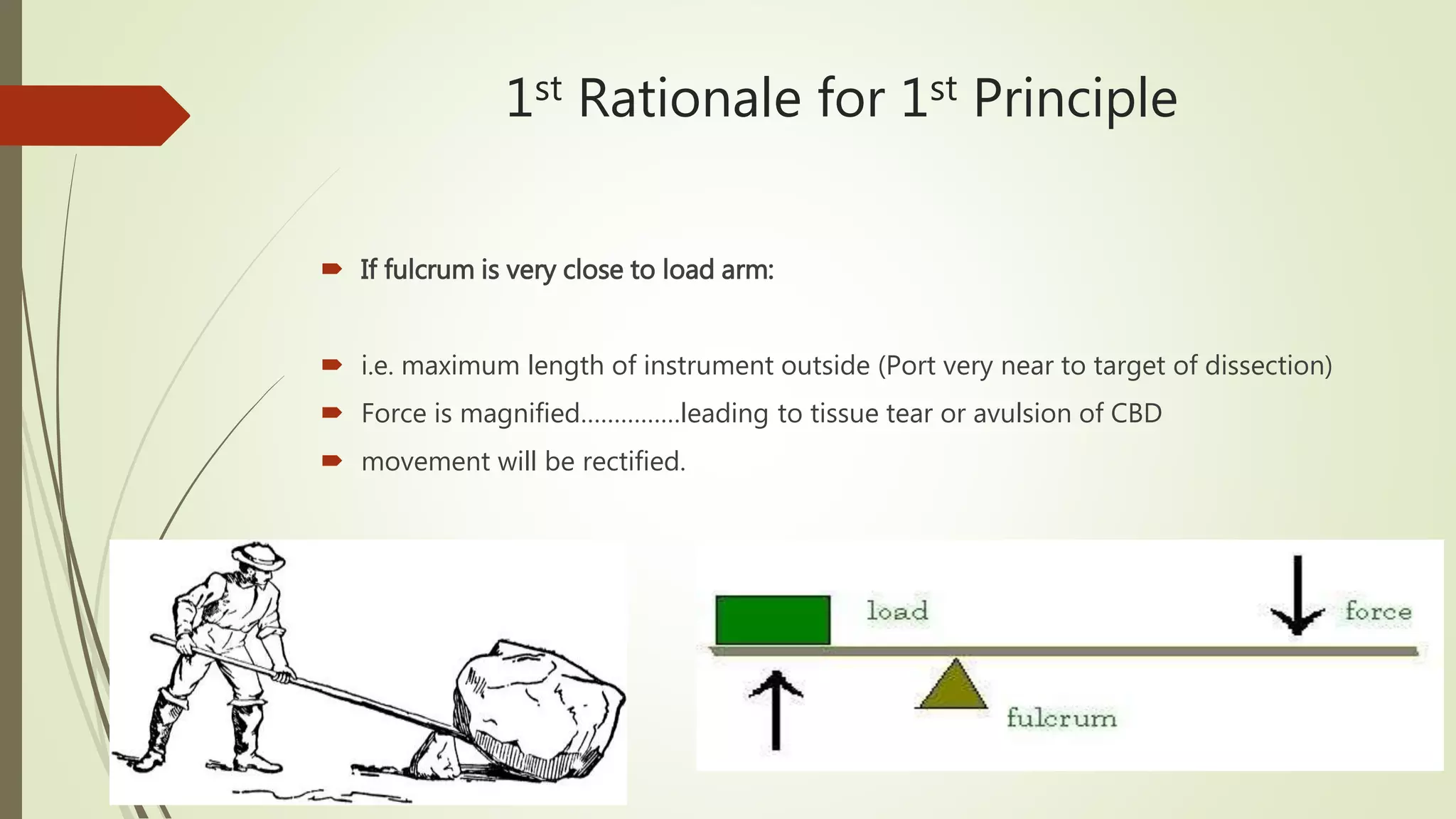 Baseball diamond concept for port position in laparoscopy | PPTX