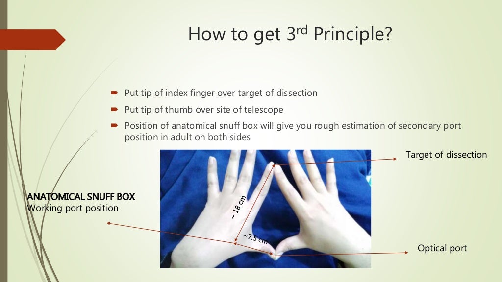 Baseball diamond concept for port position in laparoscopy
