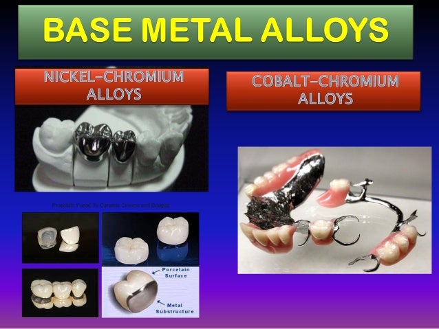 Base Metal Casting Alloys in Dentistry by Dr Rashid Hassan