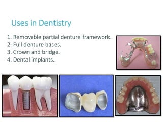 Base Metal Casting alloys Dr Ambreen | PPT