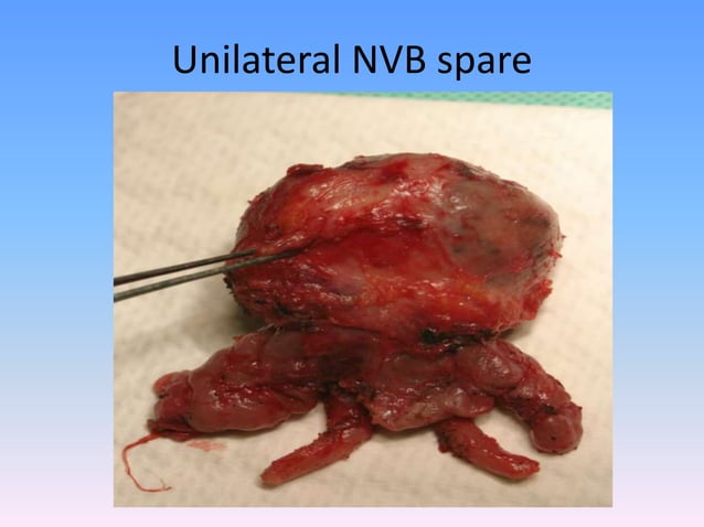 Base of prostate and lateral dissection + | PPTX