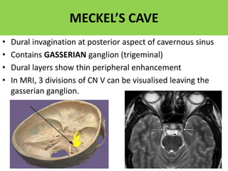“BASE OF SKULL: ANATOMY and APPLIED ASPECT” | PDF