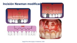 BASES DE CIRUGIA PERIODONTAL.pptx
