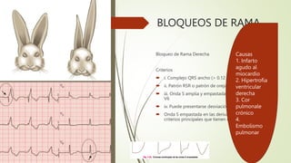 bases de ECG en UCI.pptx