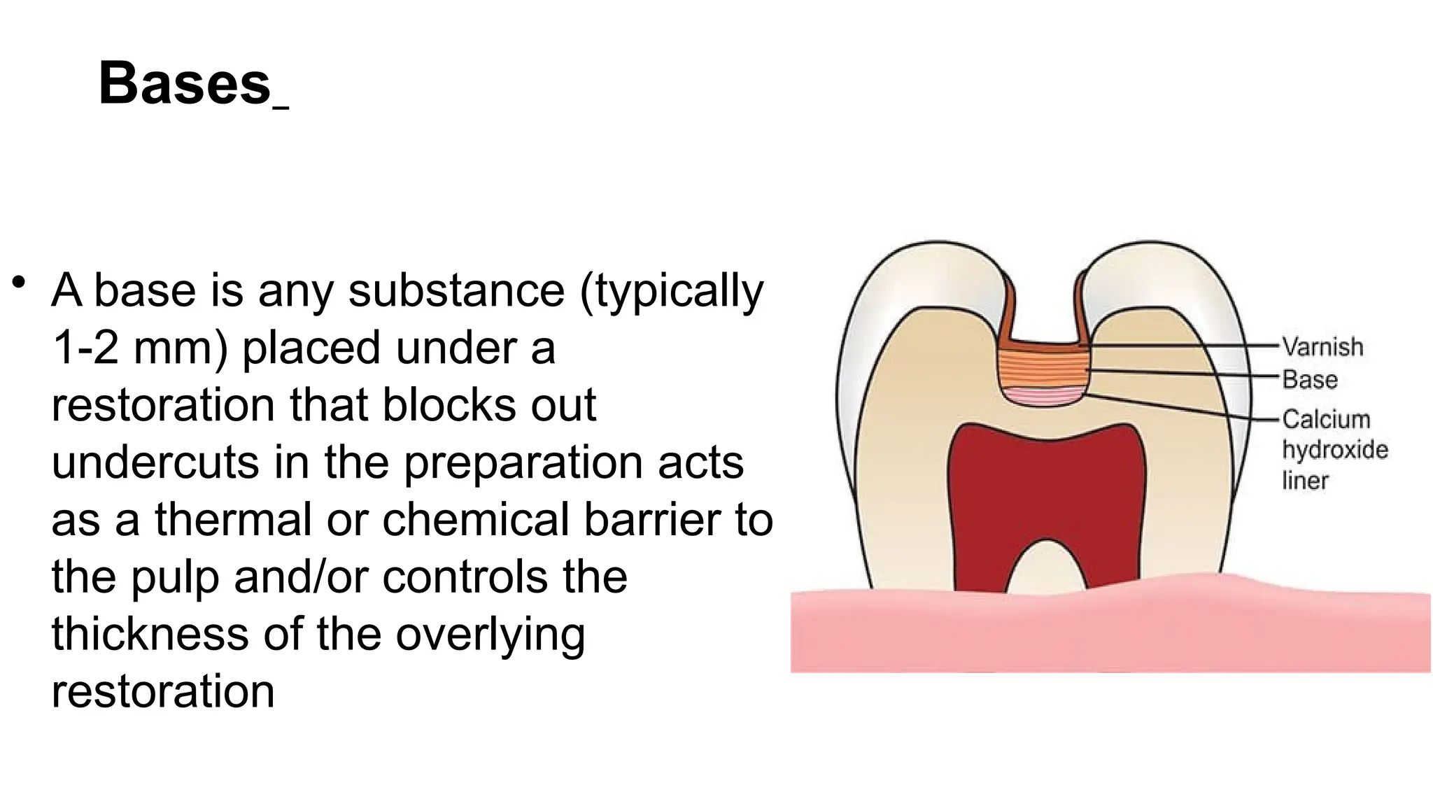 BASES & LINER IN DENTAL RESTORATIONSpptx | PPTX