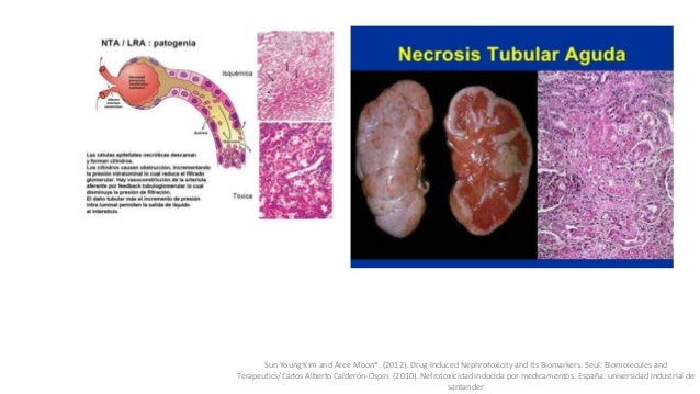 Bases Moleculares de la Nefrotoxicidad Inducida por Farmacos