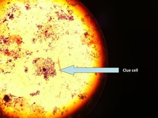 Bashh bacterial vaginosis guideline summary | PPT