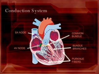 Basic Arrythmias | PDF