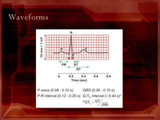 Basic Arrythmias | PDF