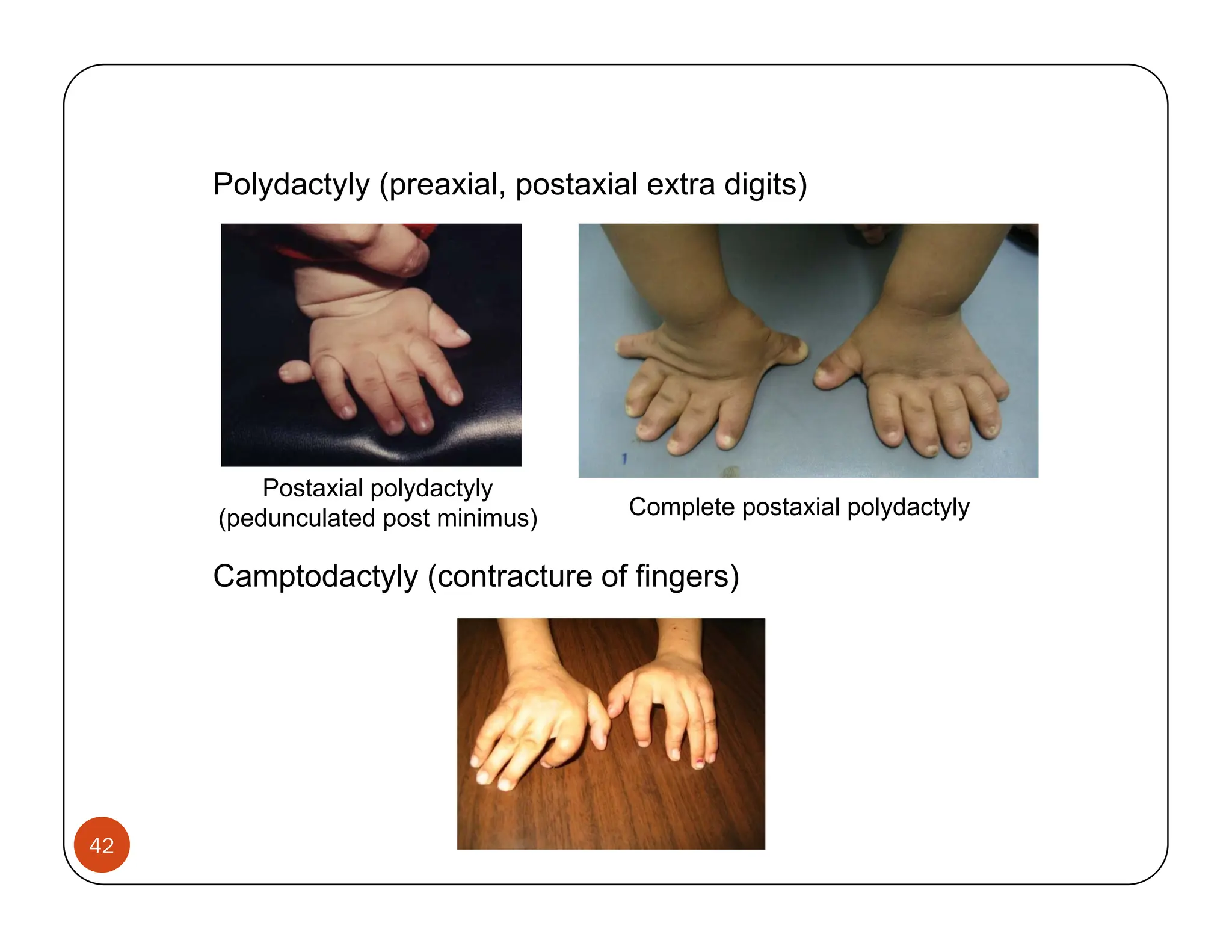 Basic-concepts-dysmorphology-Temtamy-2013.pdf