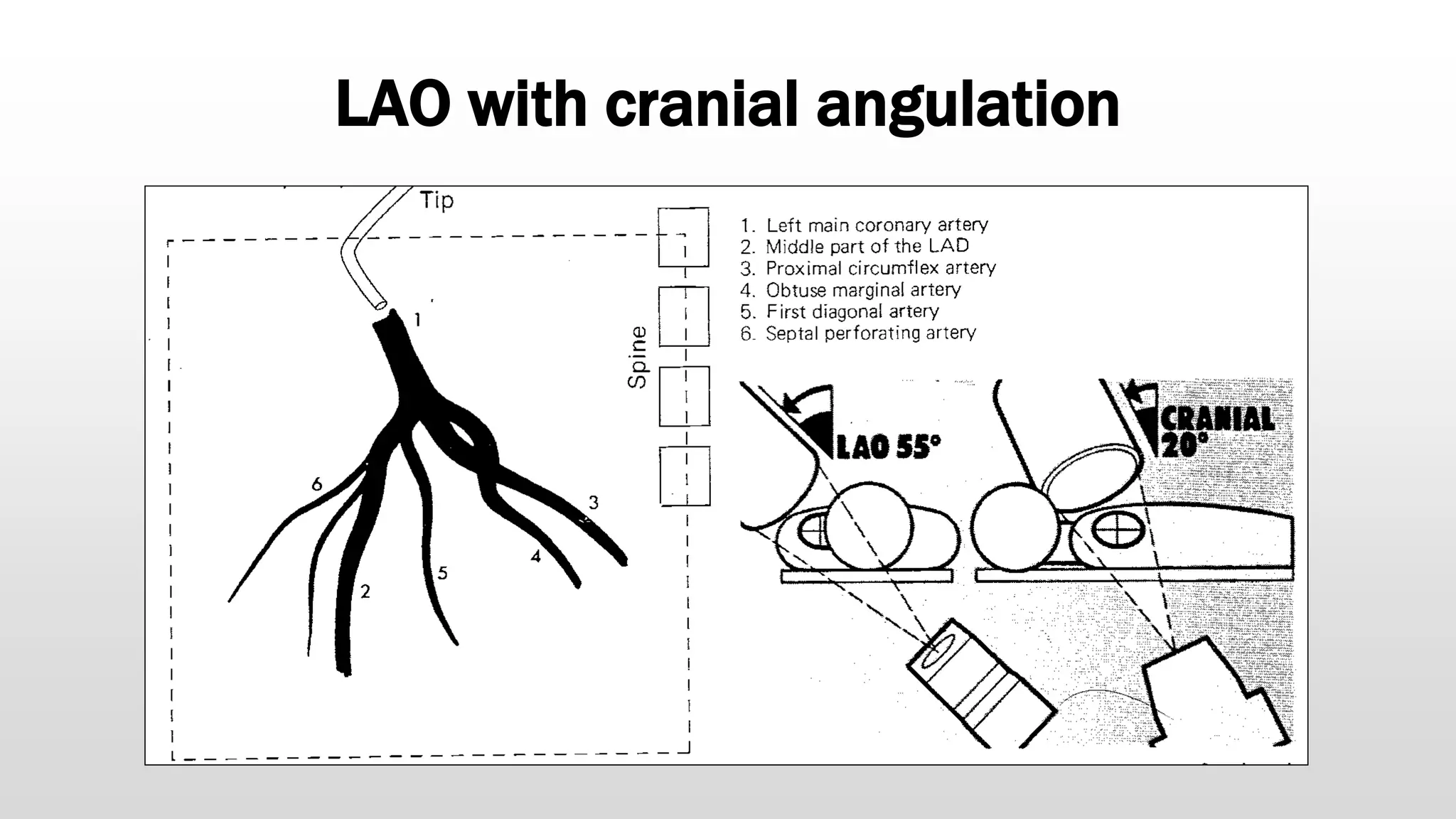 Basic-Coronary-Angiography_All-Slides.pdf