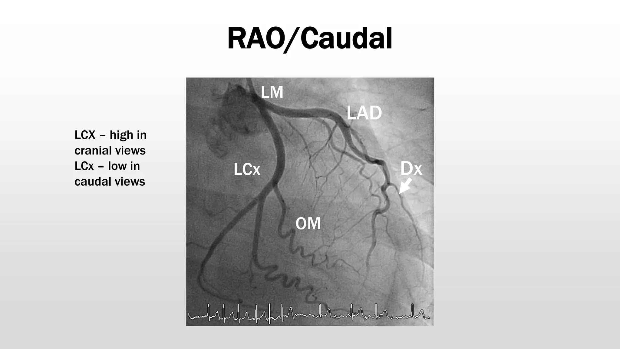 Basic-Coronary-Angiography_All-Slides.pdf