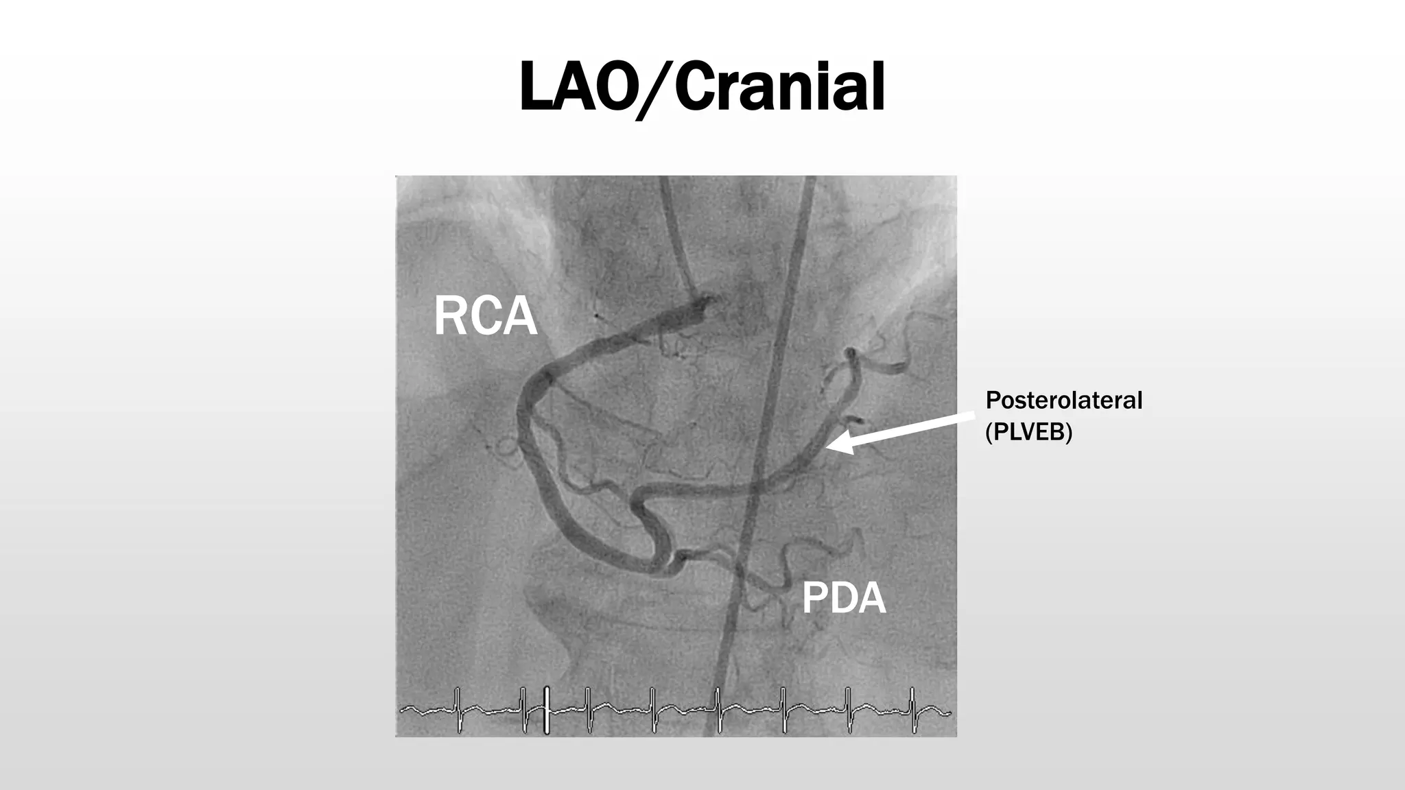 Basic-Coronary-Angiography_All-Slides.pdf