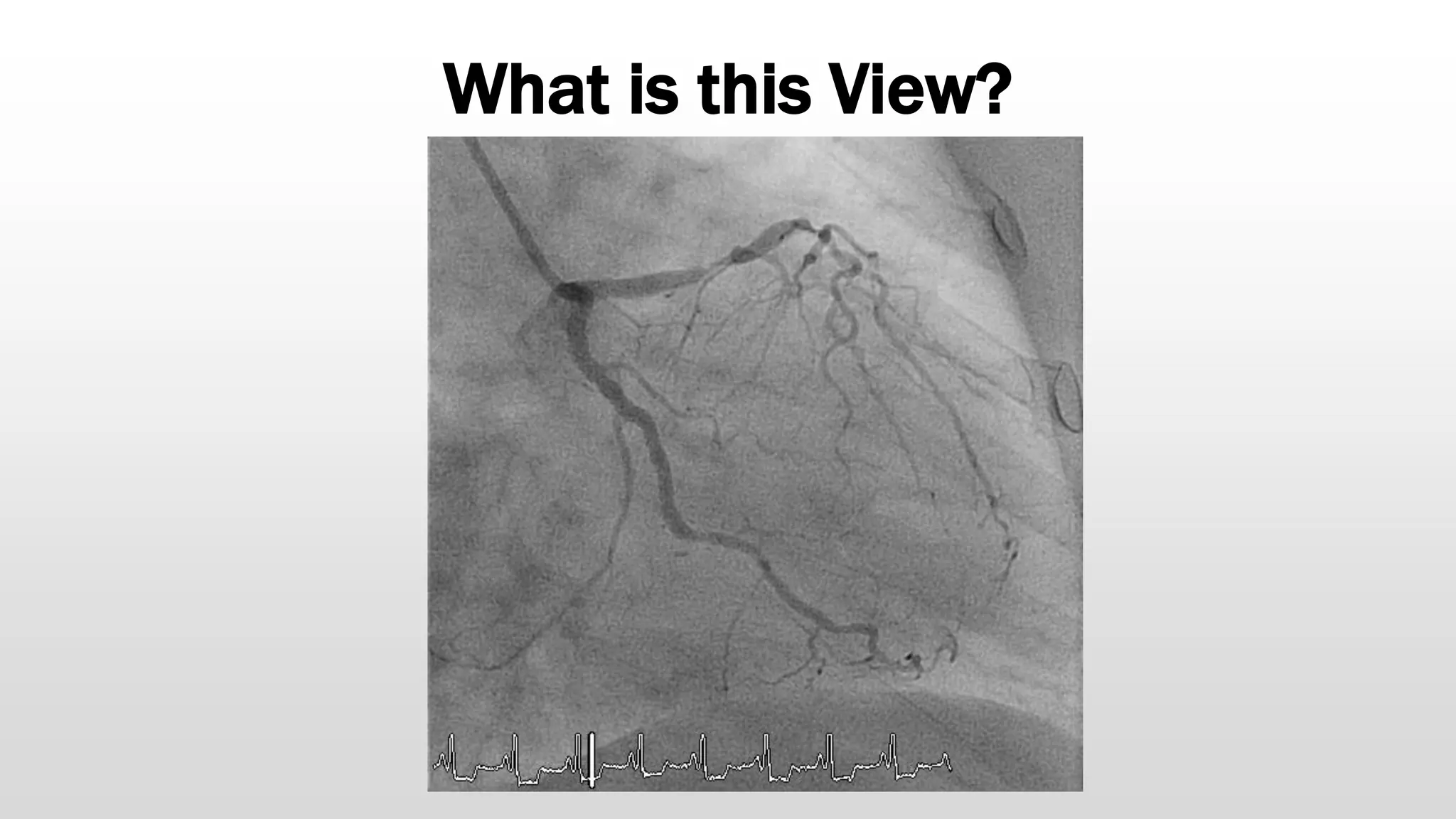 Basic-Coronary-Angiography_All-Slides.pdf