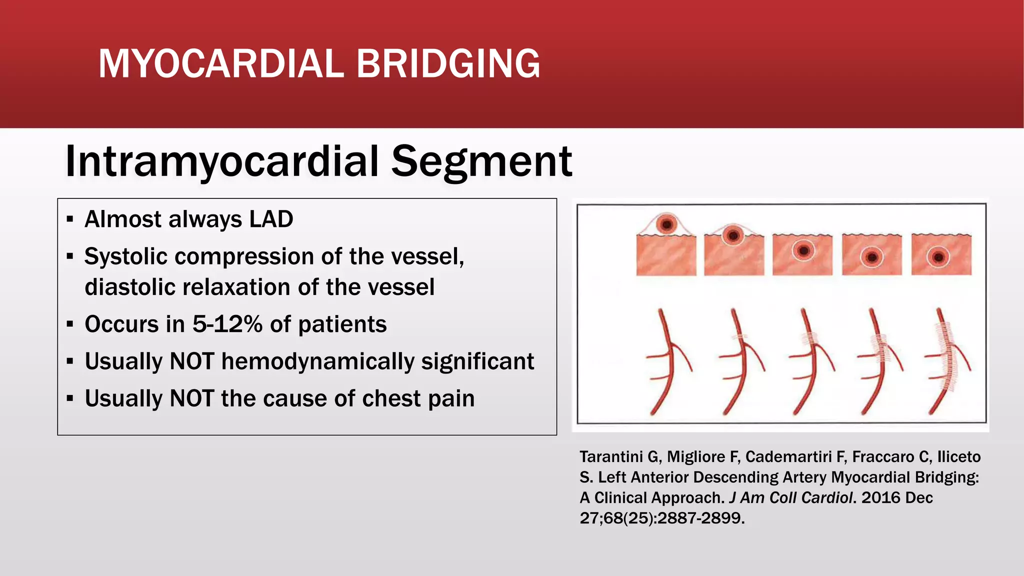 Basic-Coronary-Angiography_All-Slides.pdf