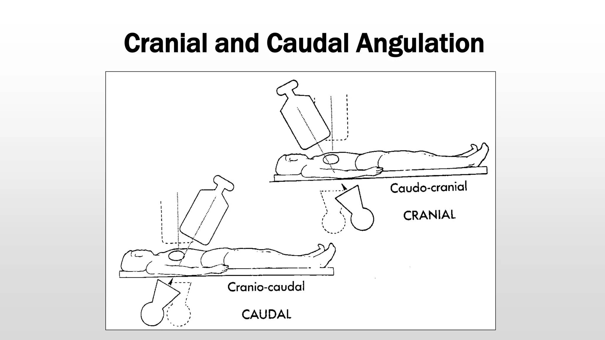 Basic-Coronary-Angiography_All-Slides.pdf