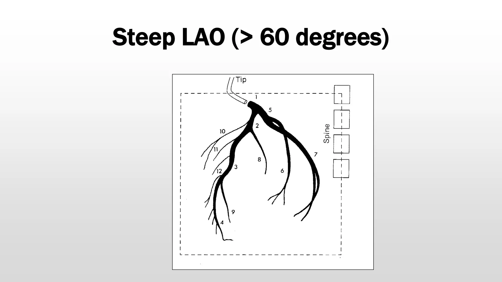 Basic-Coronary-Angiography_All-Slides.pdf