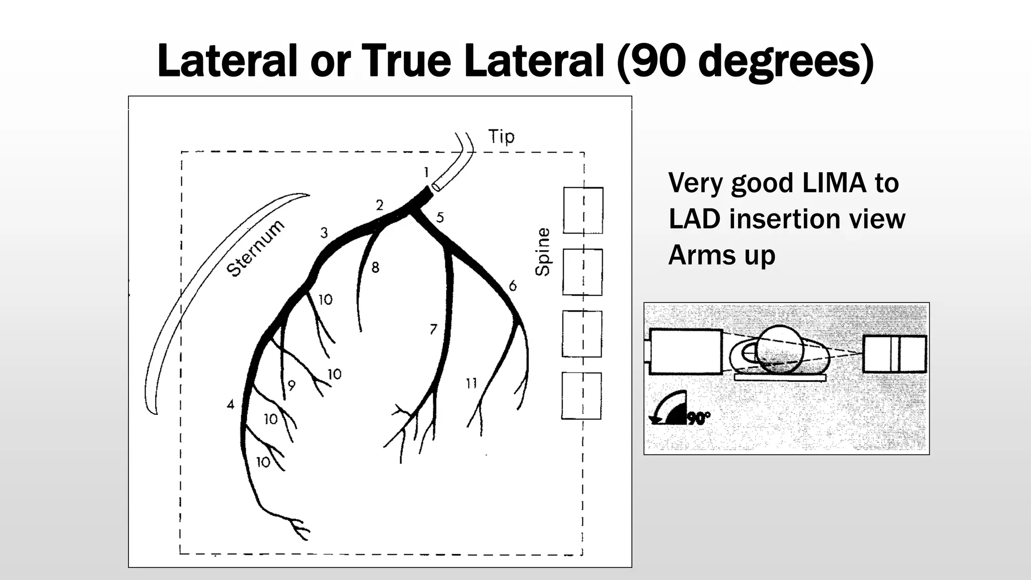 Basic-Coronary-Angiography_All-Slides.pdf