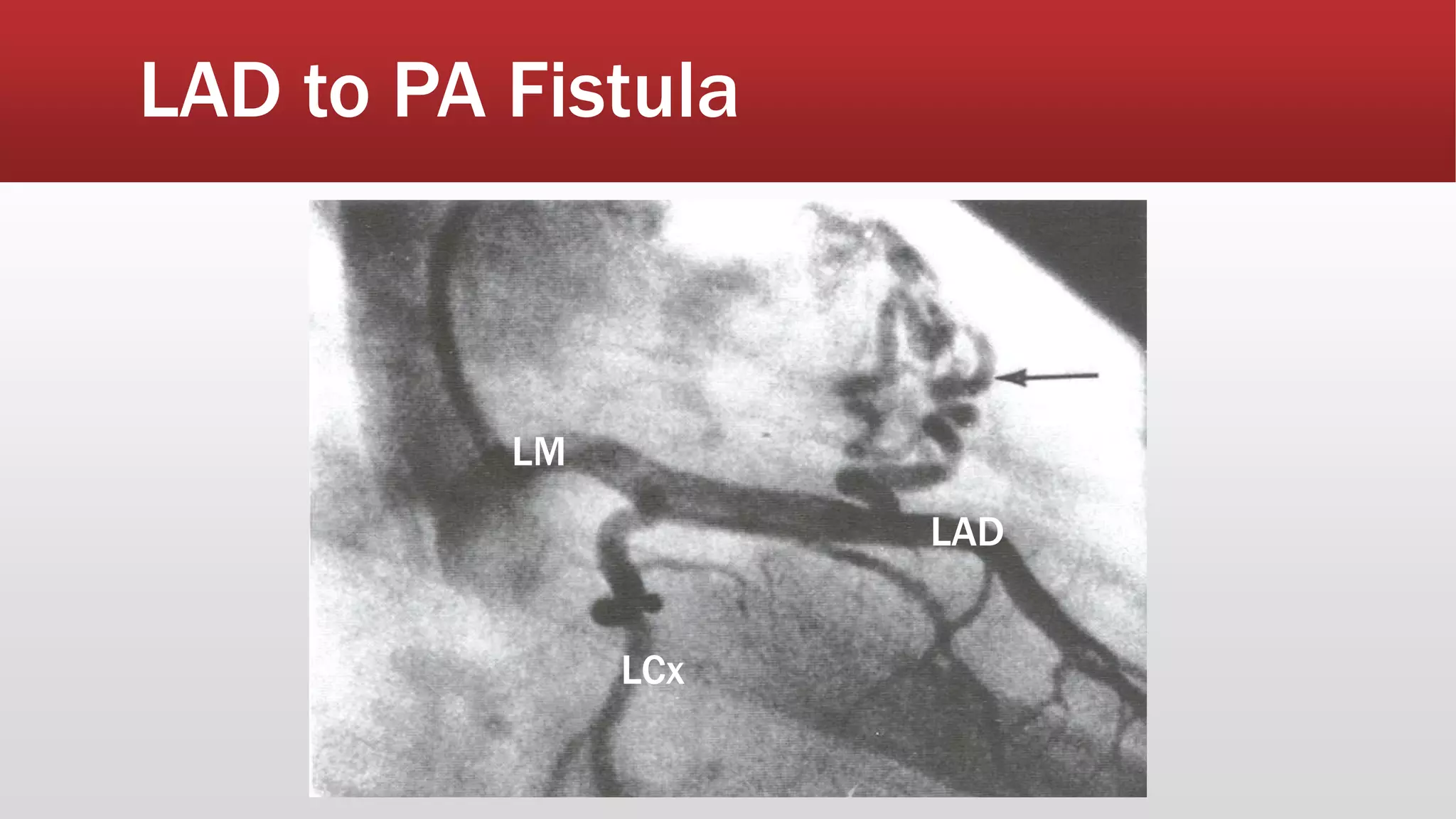 Basic-Coronary-Angiography_All-Slides.pdf
