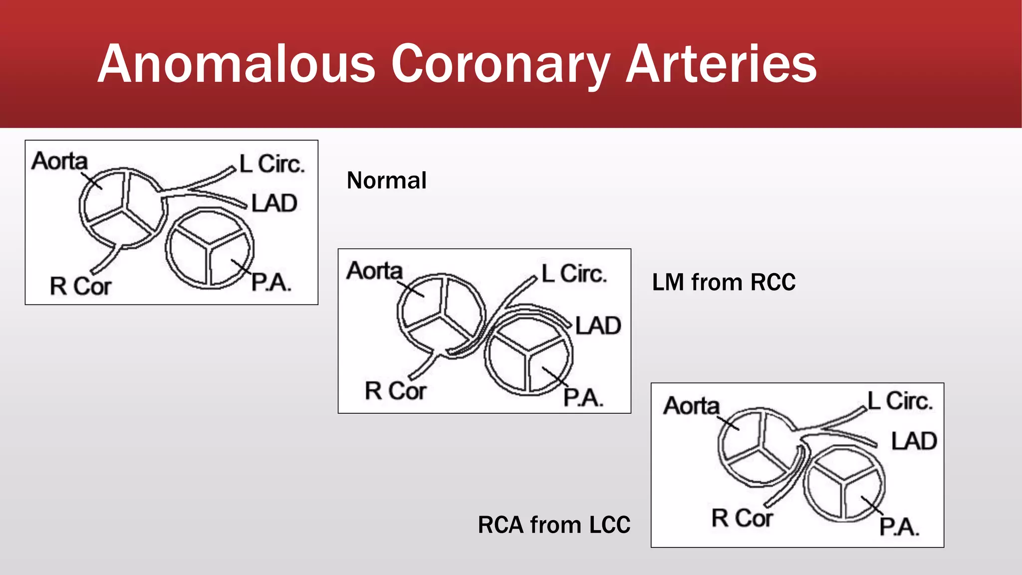 Basic-Coronary-Angiography_All-Slides.pdf