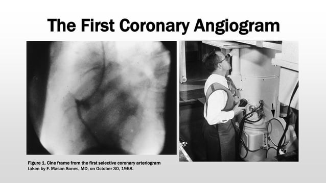 Basic Coronary Angiography All Slides Pdf