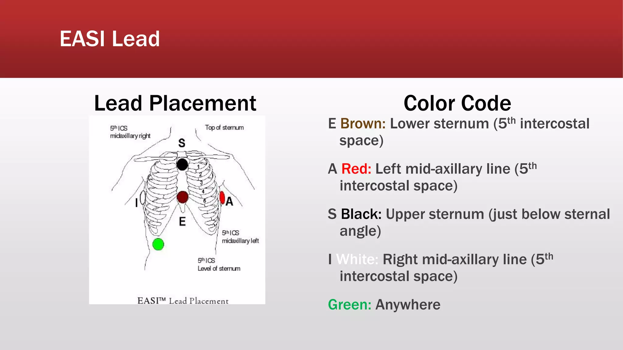 Basic-EKG-Refresher.pdf