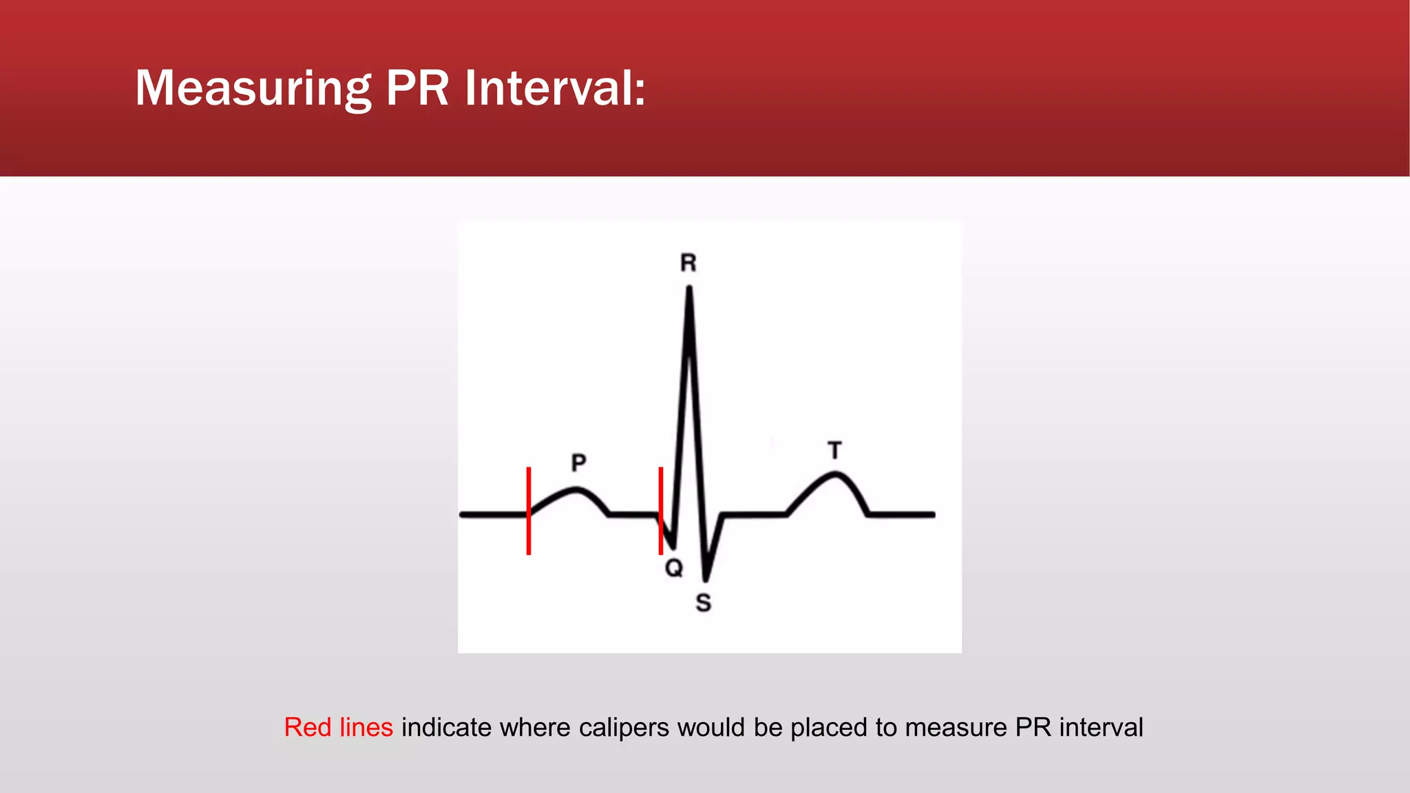 Basic-EKG-Refresher.pdf
