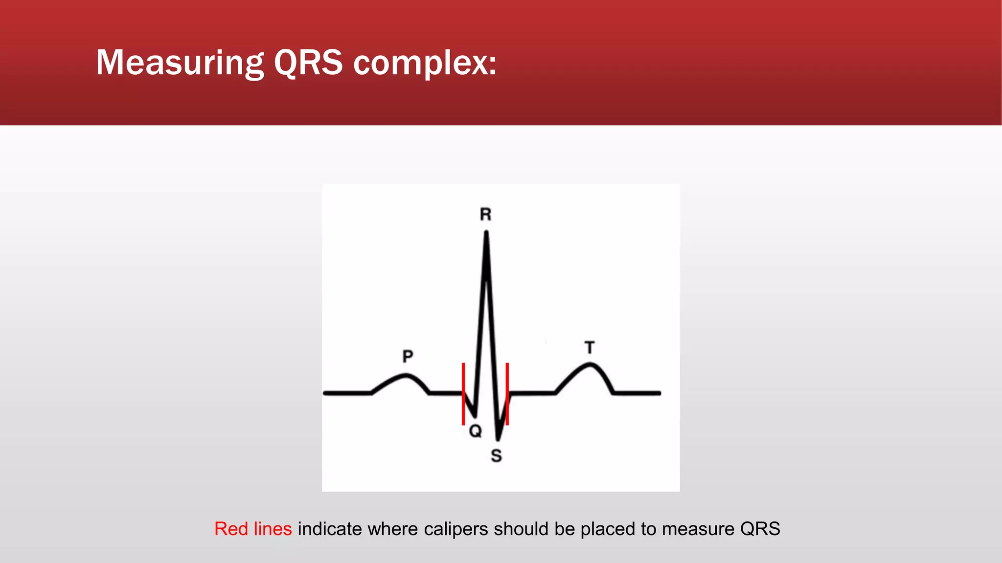 Basic-EKG-Refresher.pdf